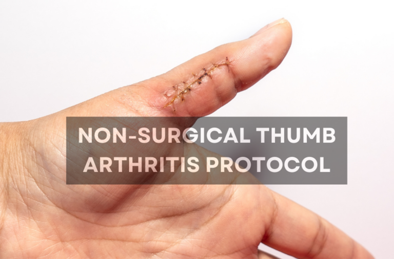 Innovative Non-Surgical Treatment for Thumb Arthritis